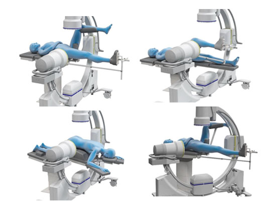 Biplanar Mobile Biplane Fluoroscopy System